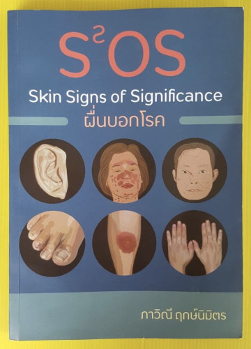 Skin Signs of Significance ผื่นบอกโรค โดย ภาวิณี ฤกษ์นิมิตร