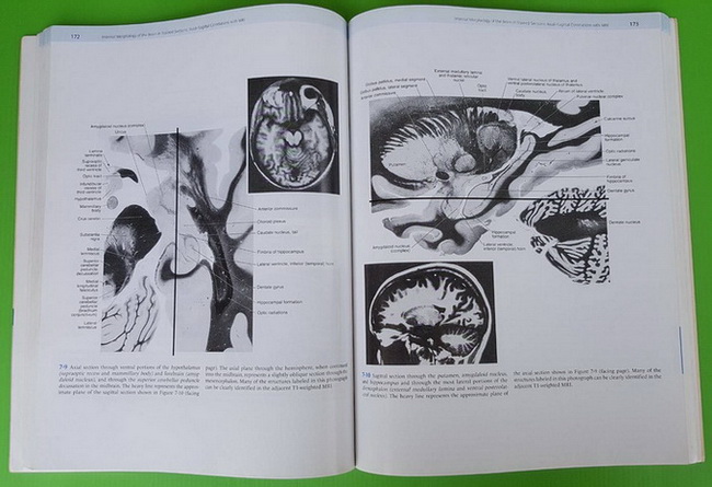 Neuroanatomy An Atlas of Structures, Sections, and Systems